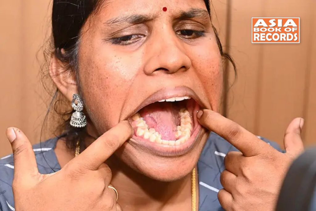 Maximum teeth in a person’s mouth (female) - Asia Book of Records