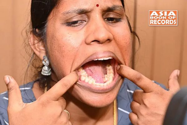 Maximum teeth in a person’s mouth (female) - Asia Book of Records